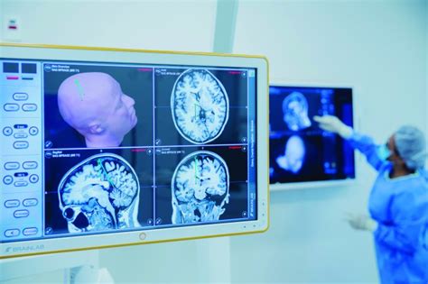 Dor De Cabeça Náuseas E Visão Turva São Alerta Para Câncer Cerebral