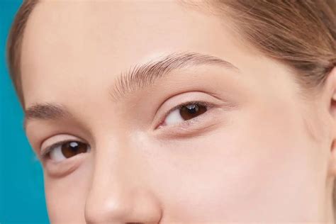Non Surgical Brow Lift Alternatives What Are Your Choices