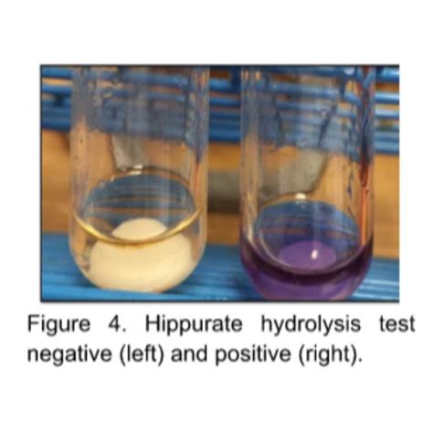Hippurate Hydrolisis Test For Group B Streptococcus Identification