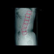 Initial Detection Results Of Vertebrae In The Seven Rotated Images