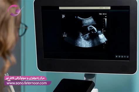 غربالگری جنین دکتر مریم یوسفی