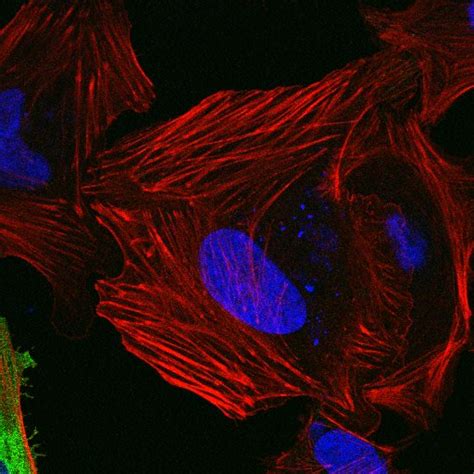 Any Suggestions On A Dapi Hoechst Artifact With Lipofectamine 3000 Transfection Researchgate