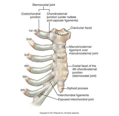 Costochondral Separation Symptoms Causes Treatment Pectus Excavatum Basicmedical Key