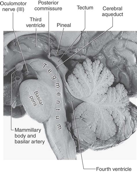The Midbrain Neupsy Key