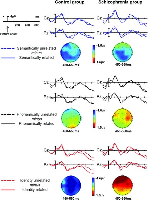 Grand Averaged Waveforms In The Control And Schizophrenia Groups