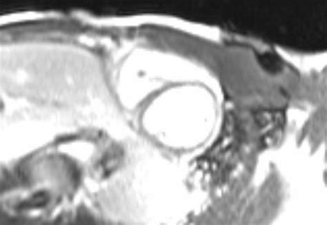 Myocardial Perfusion Mri Questions And Answers In Mri