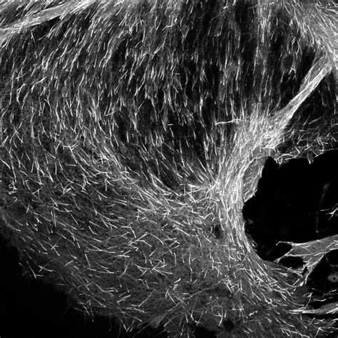 Aplysia Neuron Nikon Small World