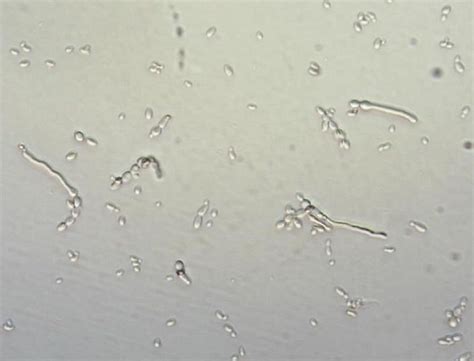 The Micrograph Of Yeast Culture Saccharomyces Cerevisiae W68 X640