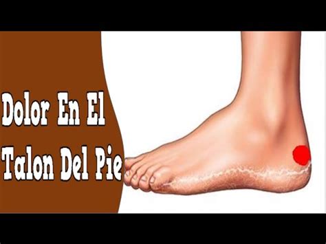 Dolor En El Talon Del Pie Curar Fascitis Plantar Dolor Planta Del Pie