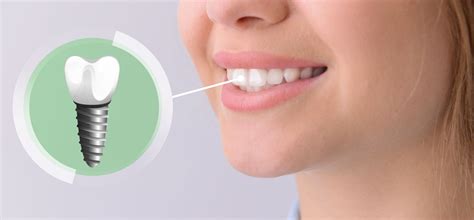 Smile Makeover In Turkey At MedicaSmile