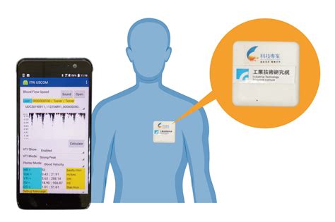 Heart Guardian Wearable Cardiac Output Monitoring Device Smart Medtech Quality Health