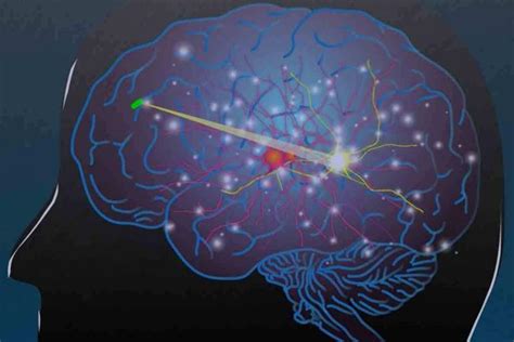 Wireless Implantable Medical Devices Cleanroom Connect