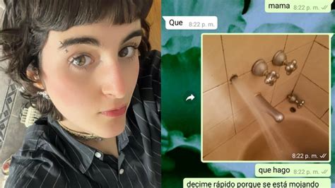 Tuvo Un Accidente Doméstico Le Pidió Ayuda A Su Mamá Pero Su Respuesta