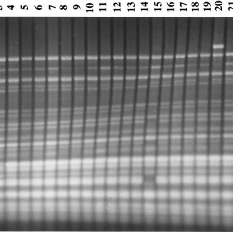 Rep Pcr Fingerprint Patterns Of Genomic Dna From Streptomyces Sp