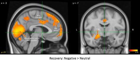 Neural Recovery Following Negative Feedback Figure Illustrates