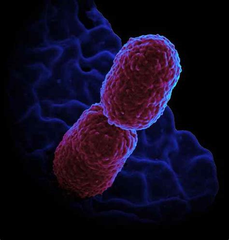 Perbedaan Antara E Coli Dan Klebsiella Prodiffs
