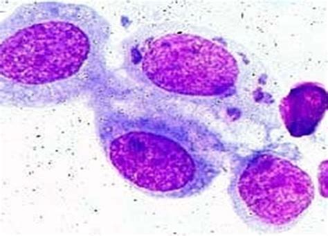 Chlamydia Stain