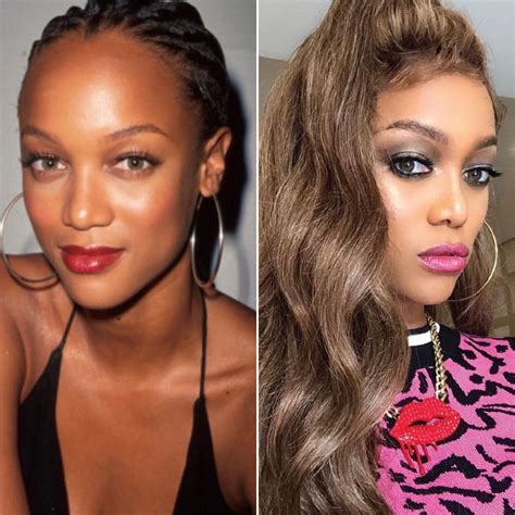 Celebrity Nose Jobs Before And After
