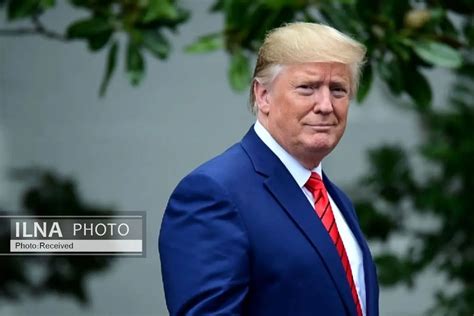 کبودی دست ترامپ خبرساز شدعکس