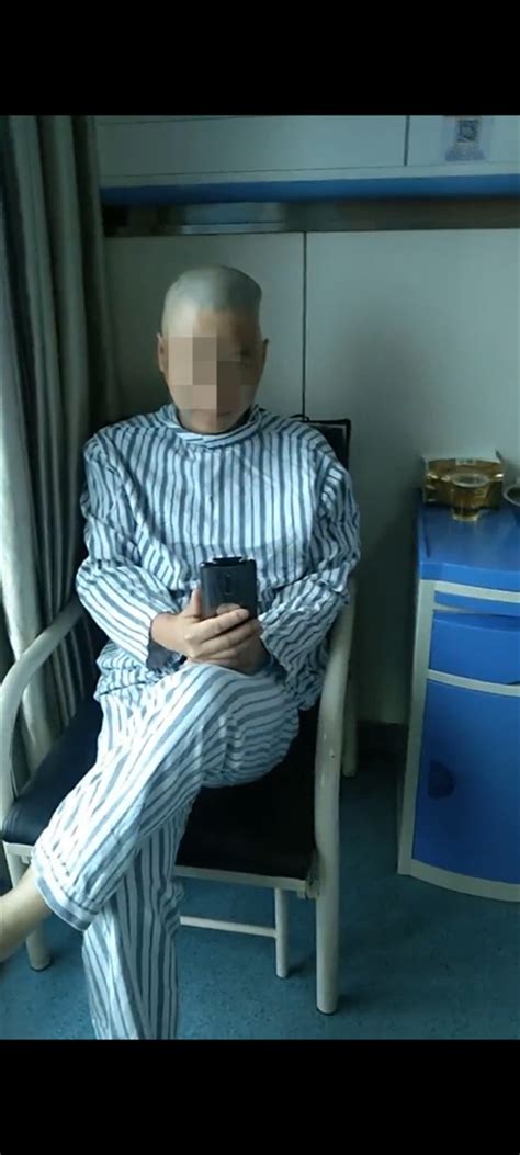 顶着缺损的颅骨14年后，帅气小伙决定再“完美”一些澎湃号·媒体澎湃新闻 The Paper