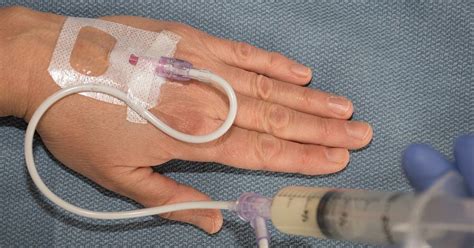 Propofol Sedation