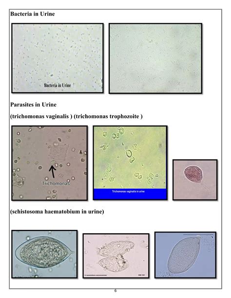 Urine Analysis And Hematology Slides Pdf