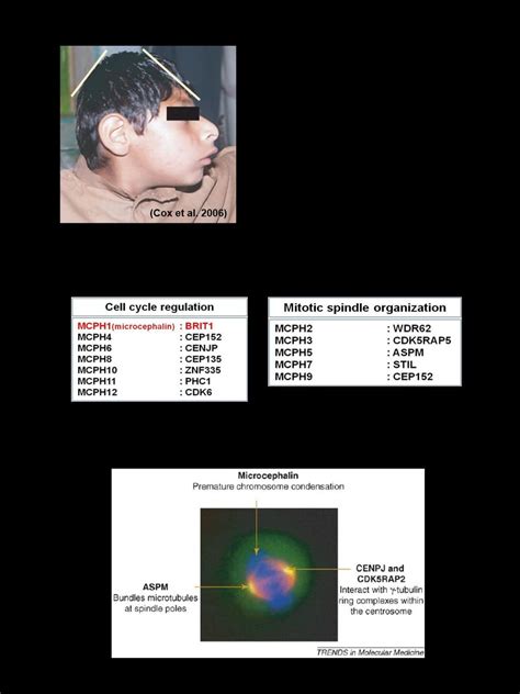 Human Microcephaly Results From A Null Mutation In One Of 12 Identified