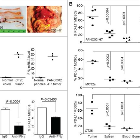 Pd L1 Protein Level In Human Colon Carcinoma Tissues A Human Colon