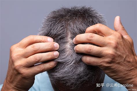 寡肽 71 Oligopeptide 71和 八肽 11 Octapeptide 11生发对比 知乎