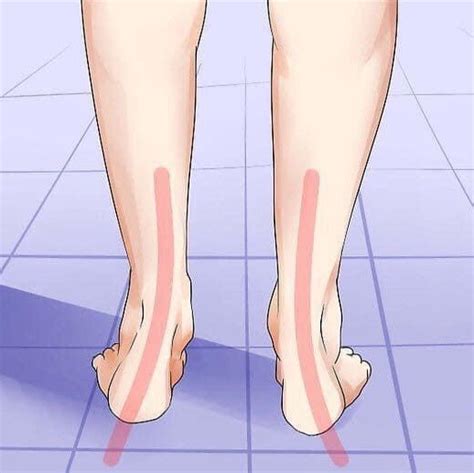 Хөлийн Нум Засагч