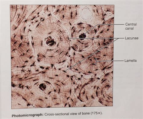 Photomicrograph Of Bone