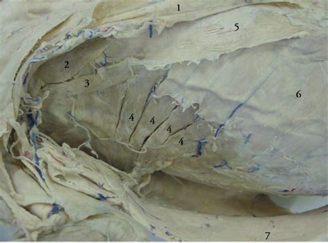 Cat Thorax Deep Diagram Quizlet