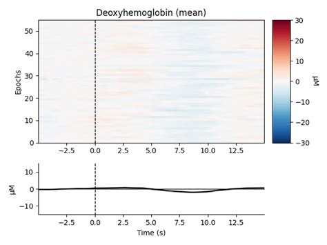 Preprocessing Functional Near Infrared Spectroscopy Fnirs Data — Mne 122 Documentation