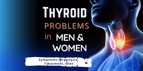 Thyroid Problems In Men And Women Symptoms Diagnosis Treatment