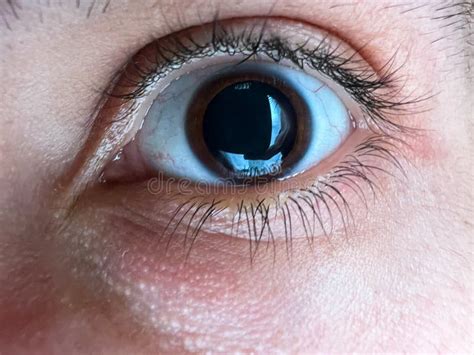 Dilated Pupils Brown Eyes