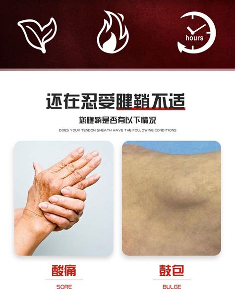 腱鞘膏健鞘囊中手指鼓包健鞘痛舒筋贴膏健翘通络手腕肿拇指关节 虎窝淘