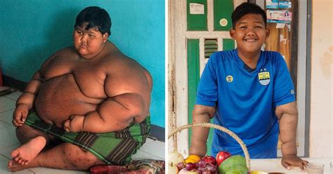 Once Called Worlds Heaviest Kid Boy Now Proves That There Is No