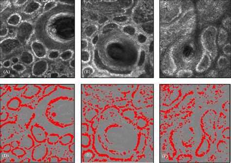 Dermal Epidermal Junction Subject 4 Representative Original