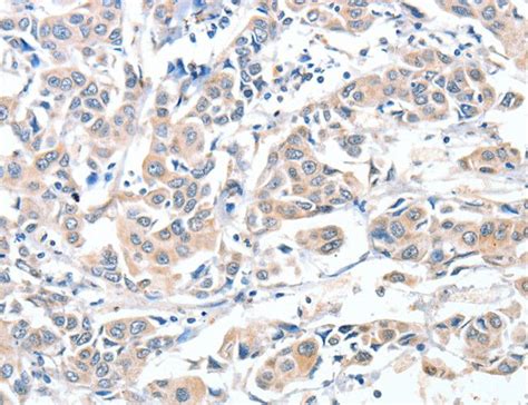 Anti Adam10 Antibody Rabbit Anti Human Polyclonal Elisa Ihc Wb Lsbio