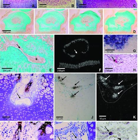 Sections Of The Tibial Epiphysis At The Beginning Of Epiphyseal Bone