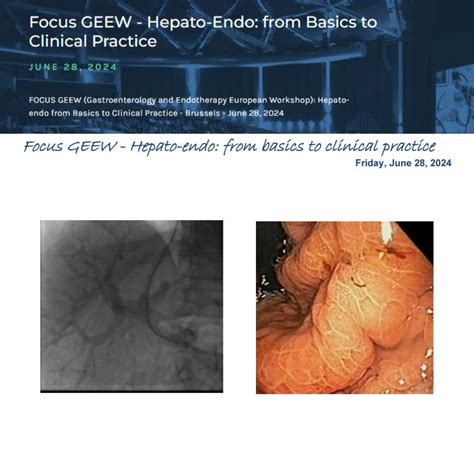 Marwan Ashraf On Linkedin Geew