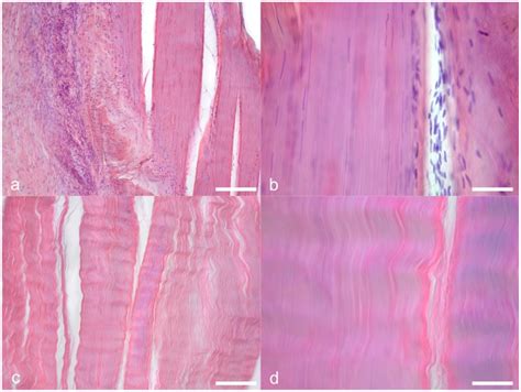 In The Native Samples A B Nuclei Are Stained In An Intensive Blue Download Scientific