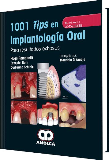 Tips en Implantología Oral Med Suq