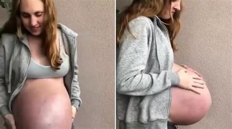 Triplets Pregnancy Progression