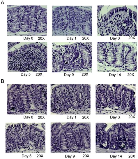 A Distal Colon B Proximal Colon Download Scientific Diagram