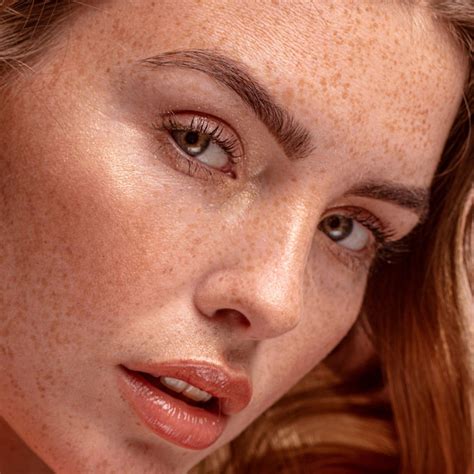 Everything You Need To Know About Pigmentation Rawkanvas