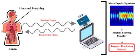 Framework Of Abnormal Breathing Detection Through Machine Learning And