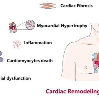 Role Of Pyroptosis In Cardiac Remodeling Pyroptosis Causes Cardiac