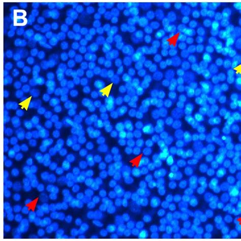 The Fraction Of Brn3a Cells In The Ganglion Cell Layer Of E18