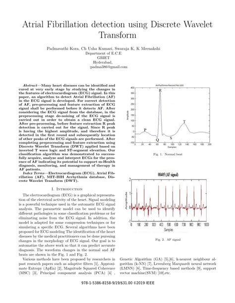 Pdf Atrial Fibrillation Detection Using Discrete Wavelet Transform